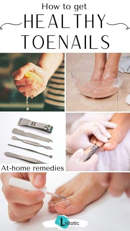 How to Get Healthy Toenails - Best Tips & Home Remedies ⋆ Listotic